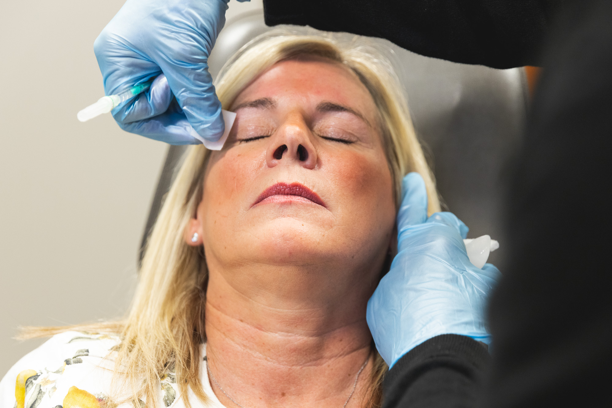 Botox in Carmel, IN - Minimally Invasive Aesthetic Surgery
